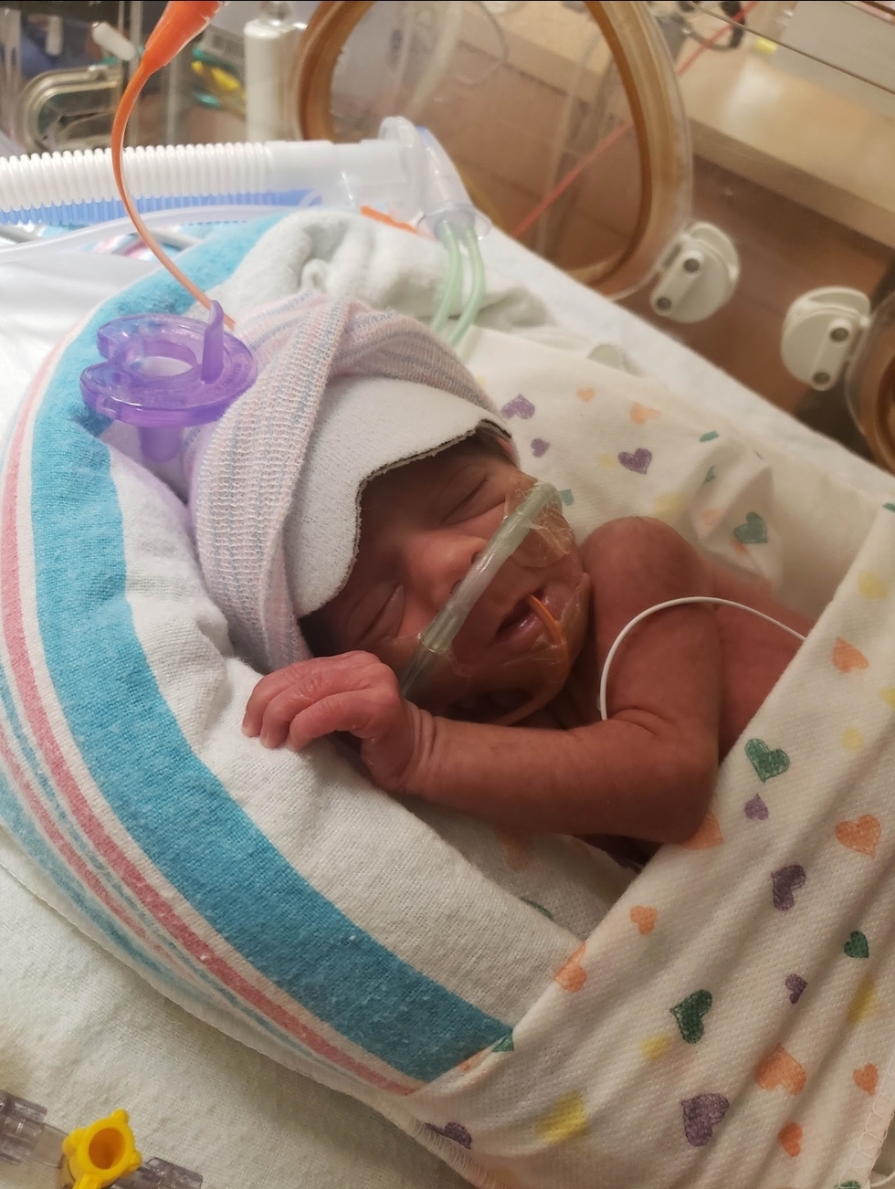 Vote for Ezra | NICU Grad Then & Now Photo Contest